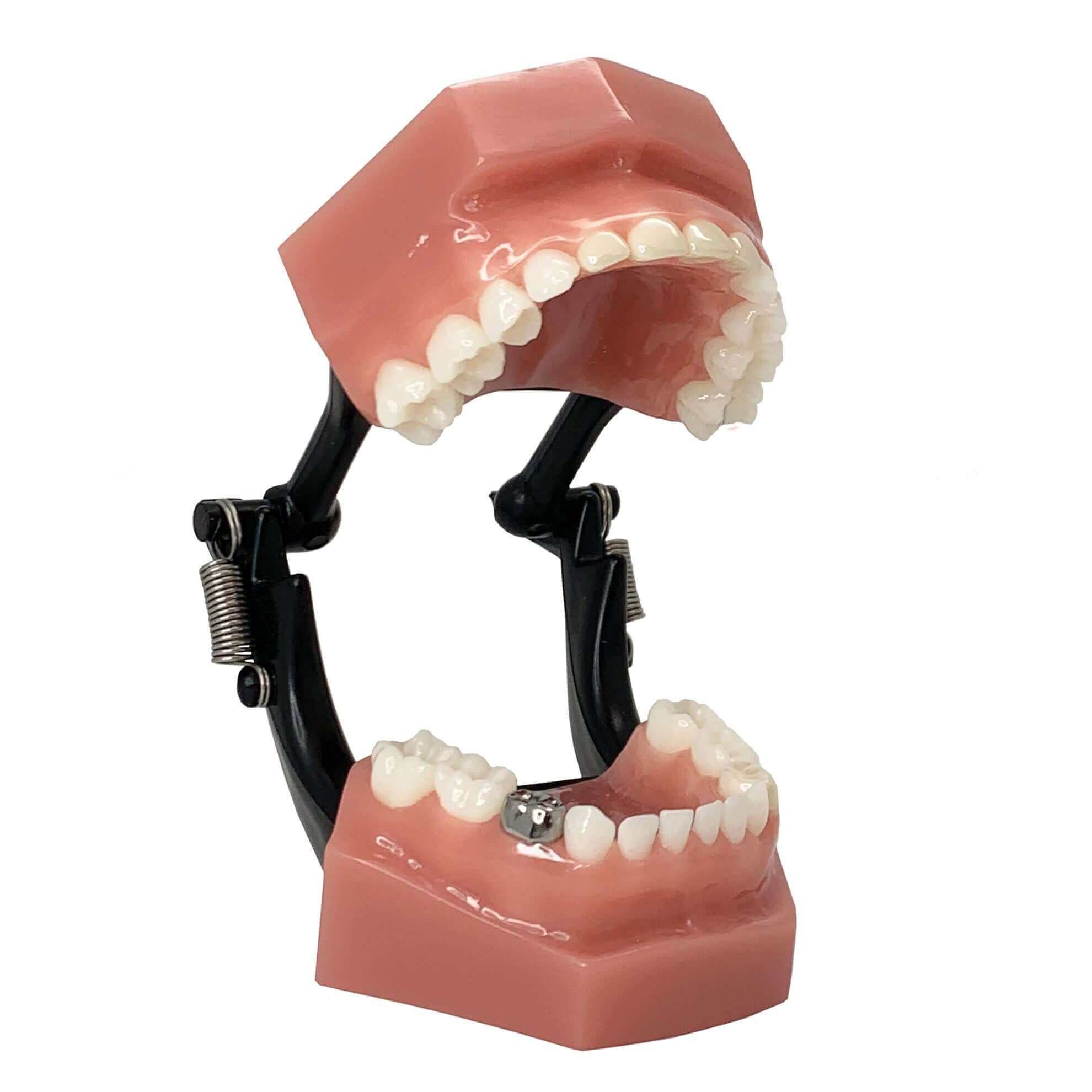 NuSmile Pediatric Crown Consultation Model B | Crown Set