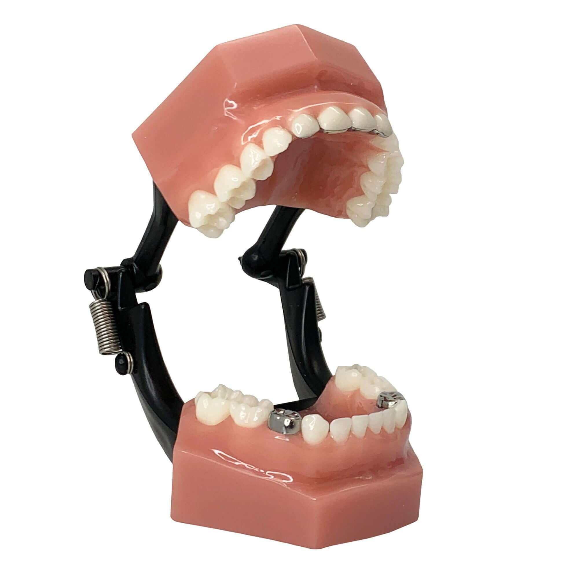 NuSmile Pediatric Crown Consultation Model C | Crown Set