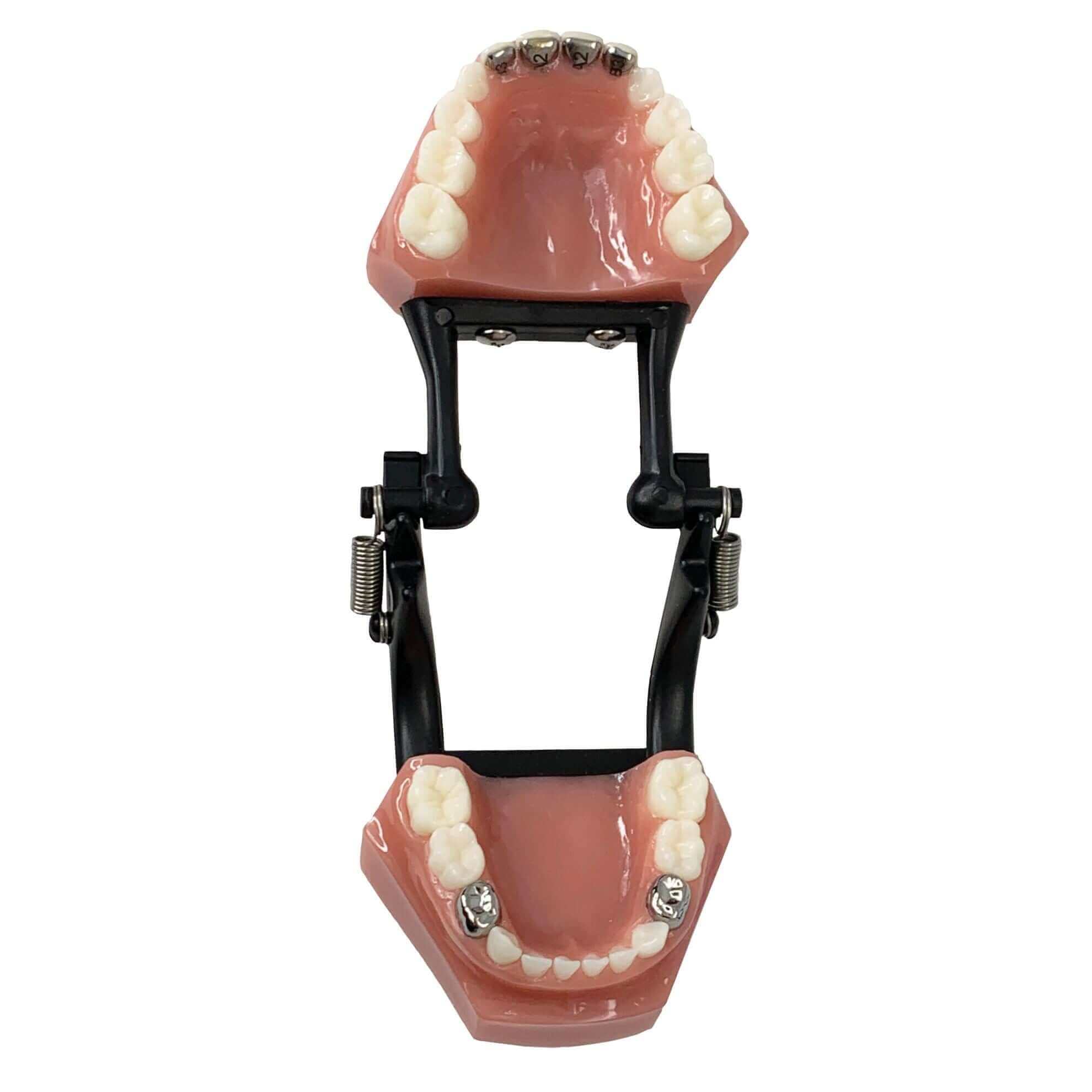 NuSmile Pediatric Crown Consultation Model C | Crown Set